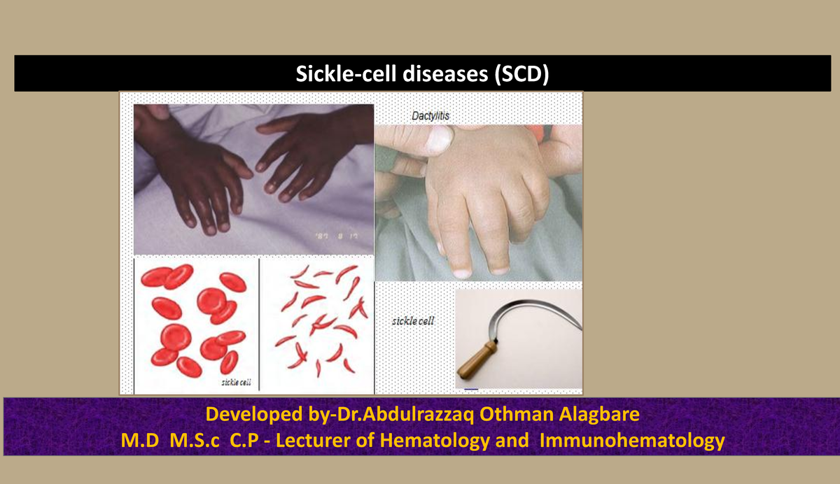 Sickle Cell Diseases (SCD): Clinical Syndromes and Lab Tests - Studocu
