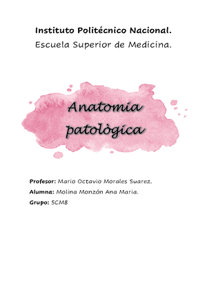 Pancreatitis - El signo de Fox es un signo clínico en el que se ...