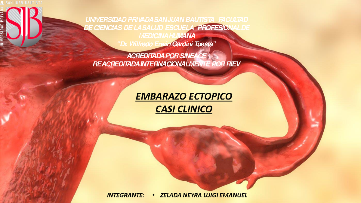 CASO Clinico SEM 3 Embarazo Ectopico - EMBARAZO ECTOPICO CASI CLINICO ...