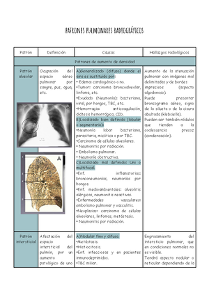 Capítulo 38 ventilación pulmonar FISIOLOGIA GUYTON Y HALL - CAPÍTULO 38 “VENTILACIÓN PULMONAR ...