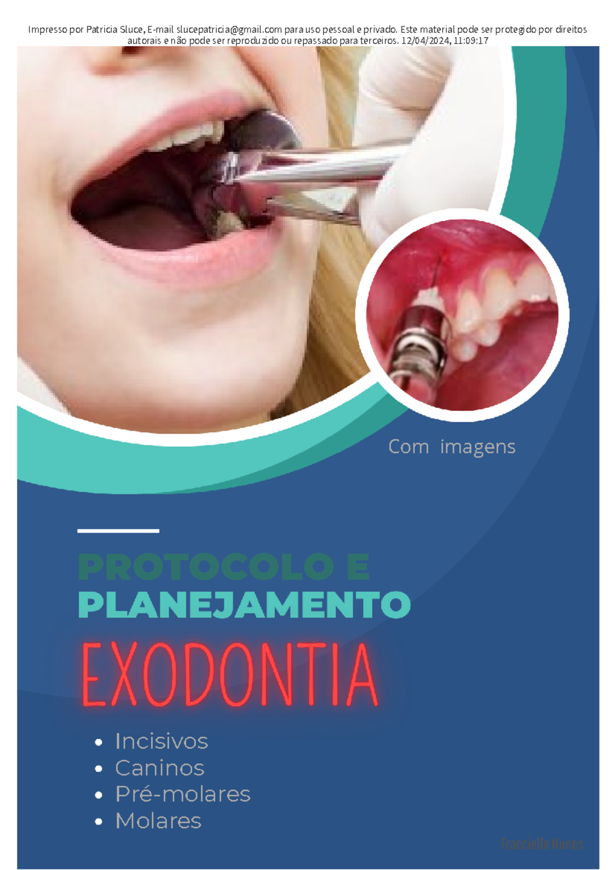Protocolo de Exodontia Completa: Planejamento e Procedimentos ...