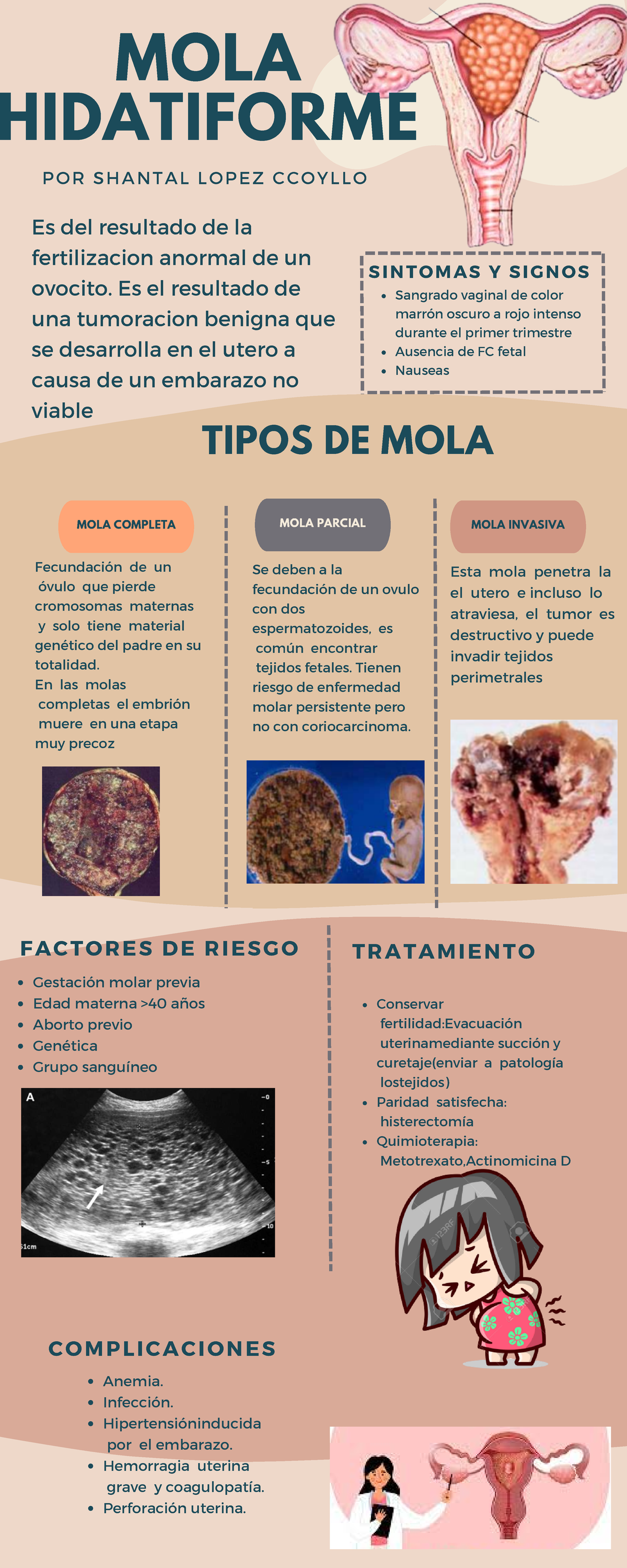 Infografía sobre Embarazo Molar: Tipos, Síntomas y Tratamiento - Studocu