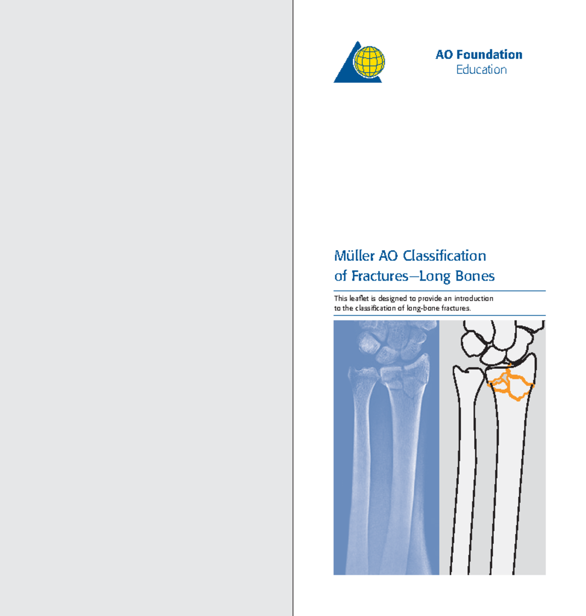 Müller AO Classification of Fractures - Long Bones Overview - Studocu