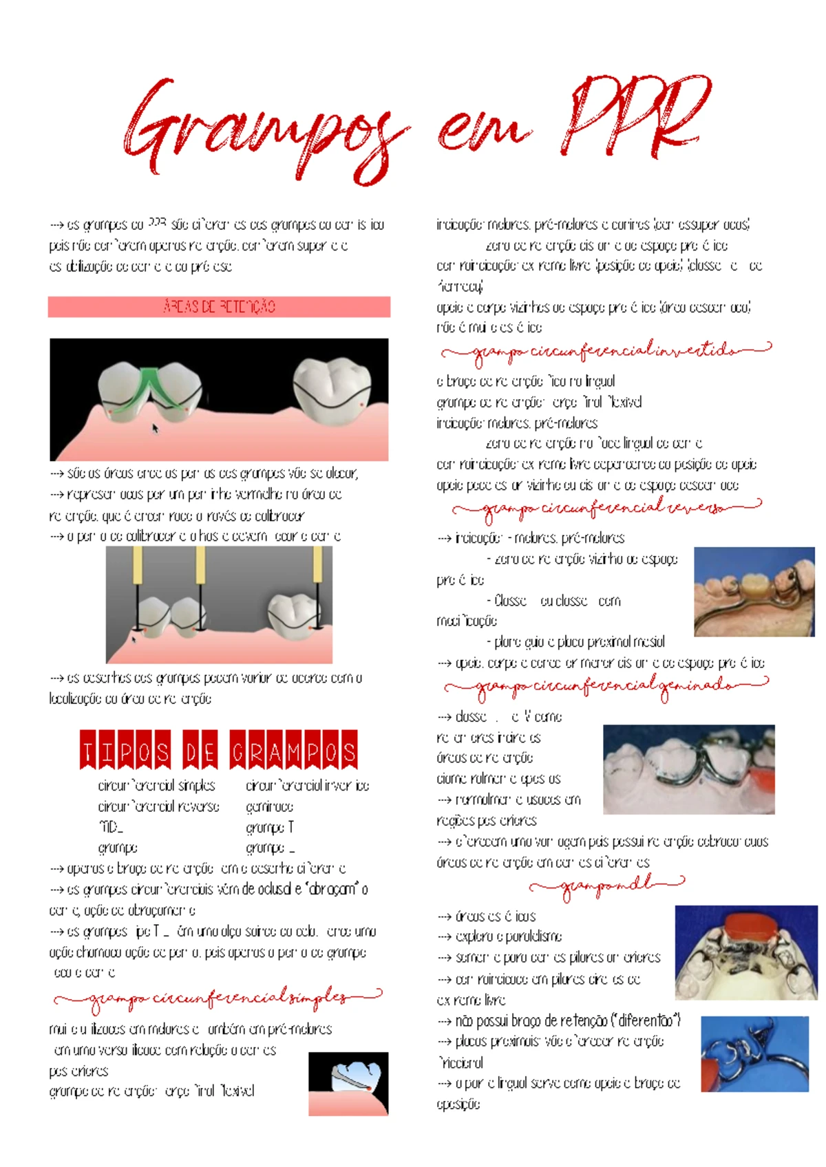 Resumo ppr - Grampos - PRÓTESE PARCIAL REMOVÍVEL Aparelhos destinados a ...