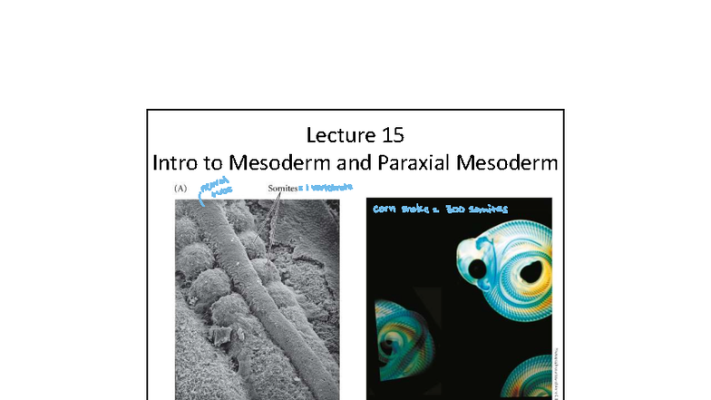 Lecture 15: Intro to Mesoderm & Paraxial Mesoderm Overview - Studocu