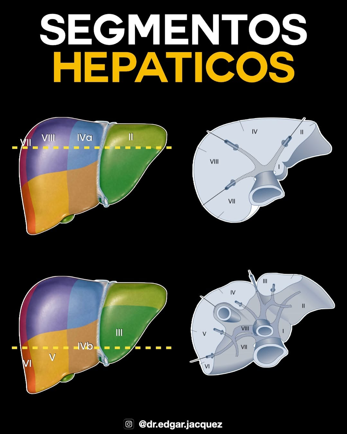 US Hepatico - Imagenologia us - Imagenología - SEGMENTOS HEPATICOS IV ...