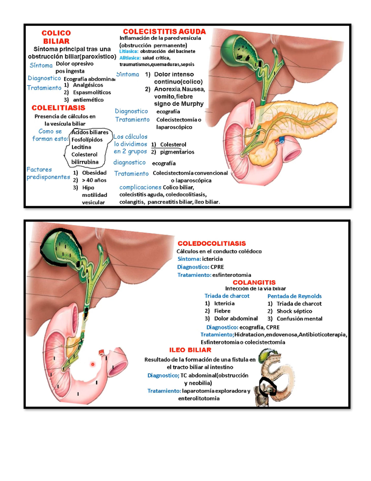 Vesicula - Resumen Cirugia - COLICO COLECISTITIS AGUDA Inflamación de ...