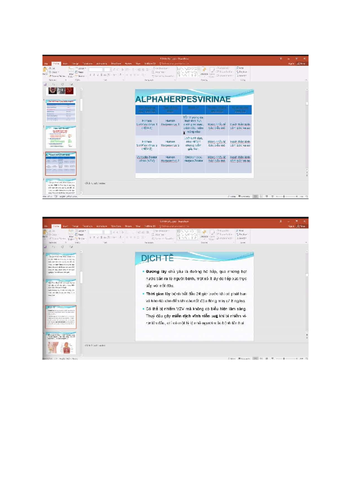 Thủy Đậu: Tài Liệu Nghiên Cứu về Virus Herpes (HSV, VZV) - Studocu