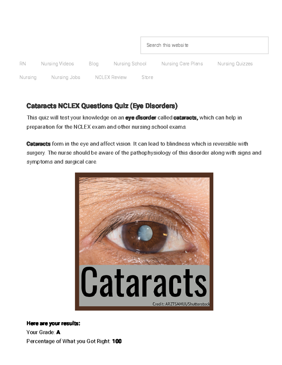 Cataracts NCLEX Nursing Quiz: Exploring Eye Disorders Knowledge - Studocu