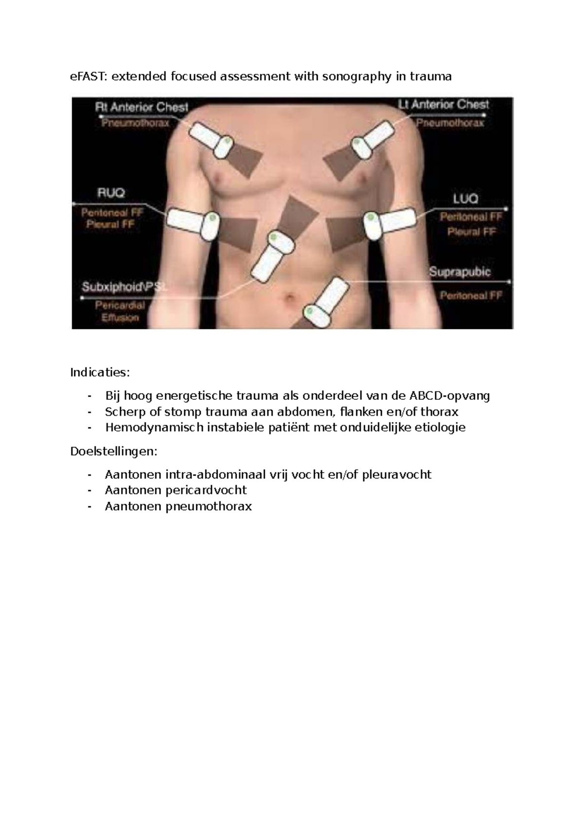 eFAST Samenvatting en Technieken voor Trauma-ECG / HET - Studeersnel