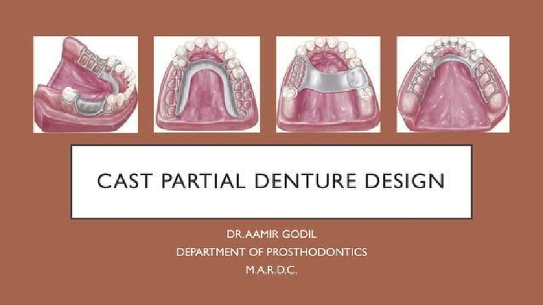 CAST Partial Denture Design - Prosthodontics M.ARD.C. Lecture Notes ...