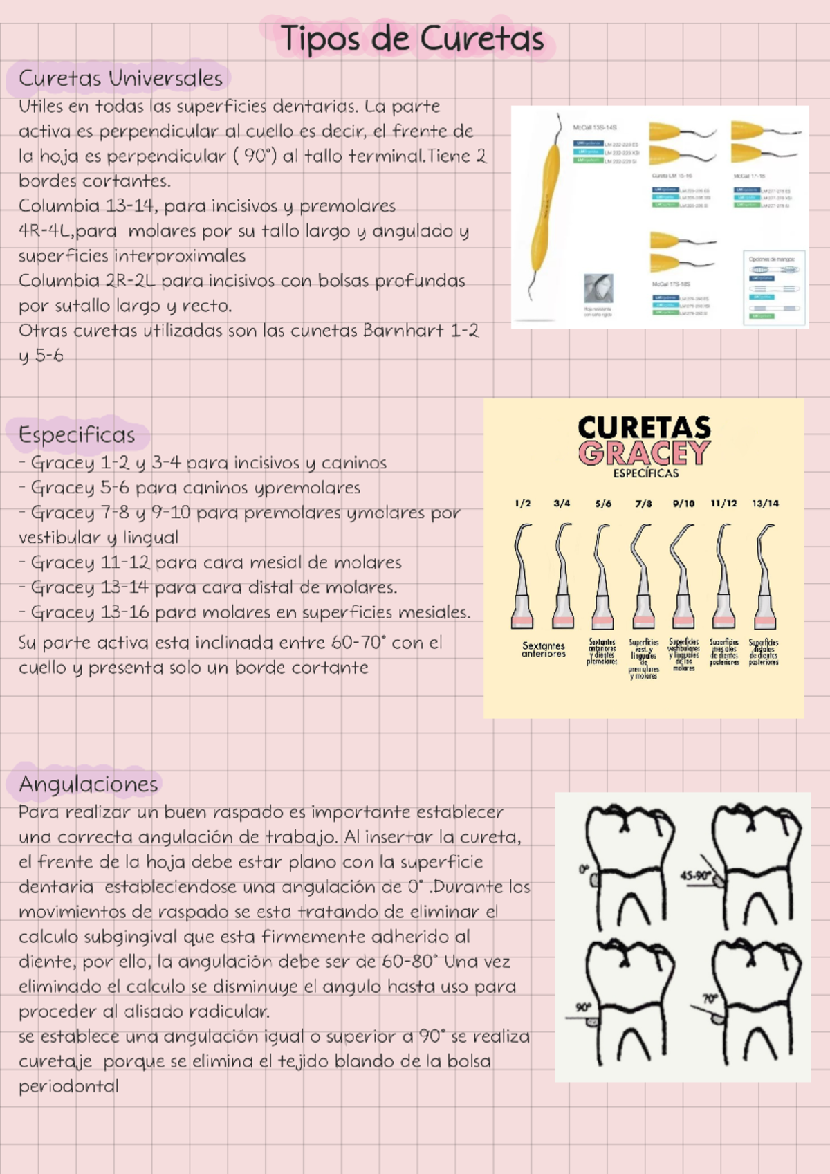 Tipos de curetas - La parte activa es perpendicular al cuello es decir ...