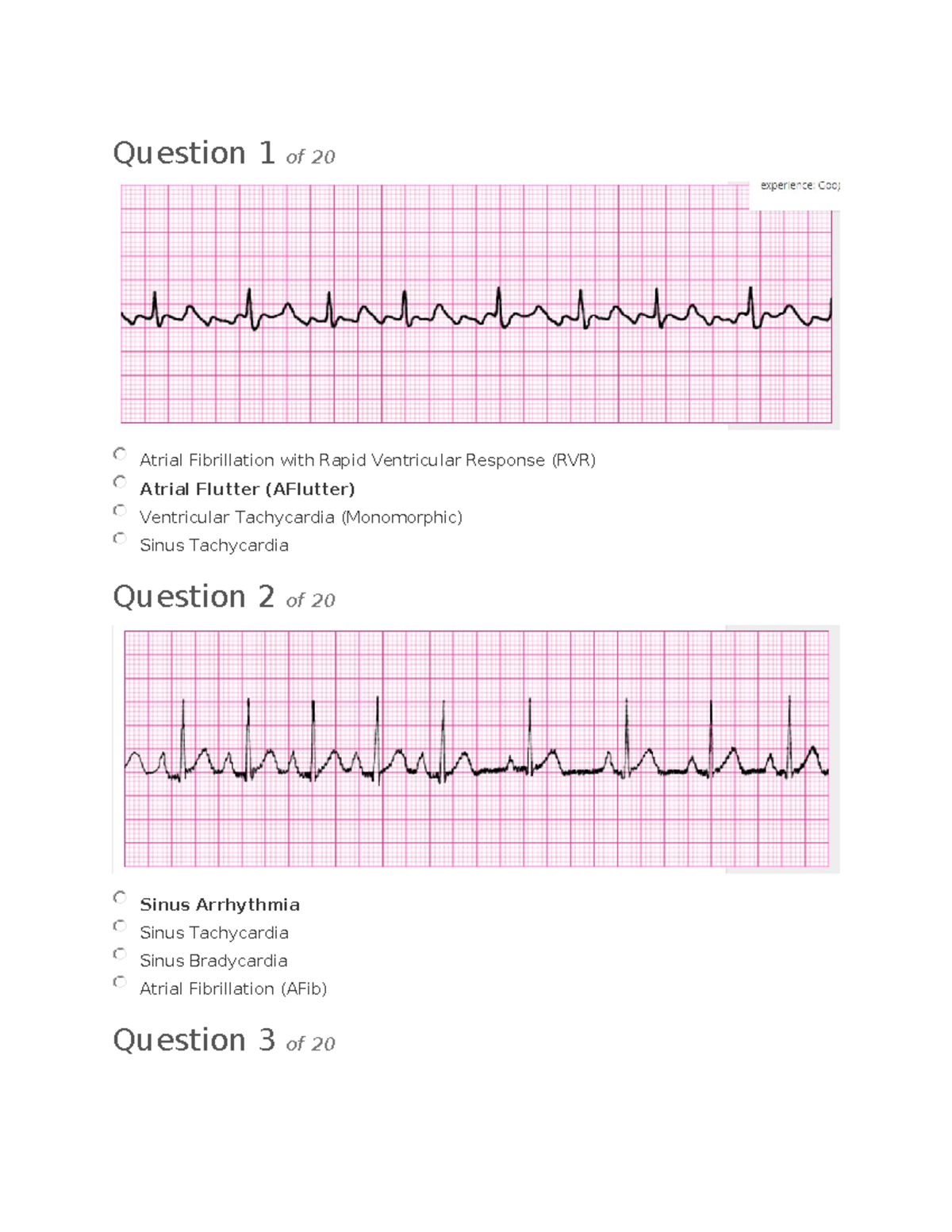 Cardiac Rhythms Review: 20 Key Topics in EKG Interpretation - Studocu