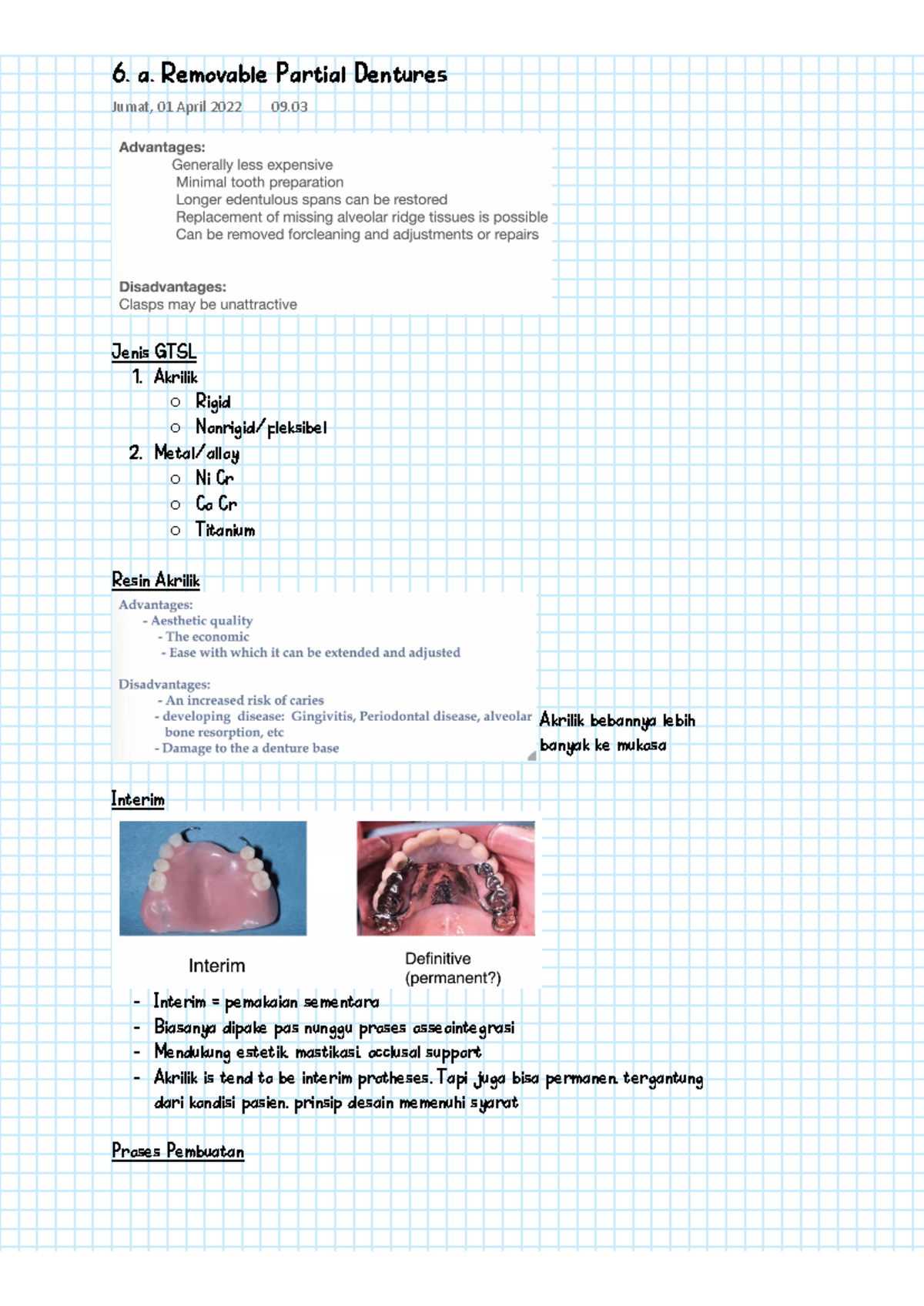 Prostodonsia II - 6a. Removable Partial Dentures Overview & Lab Proc ...