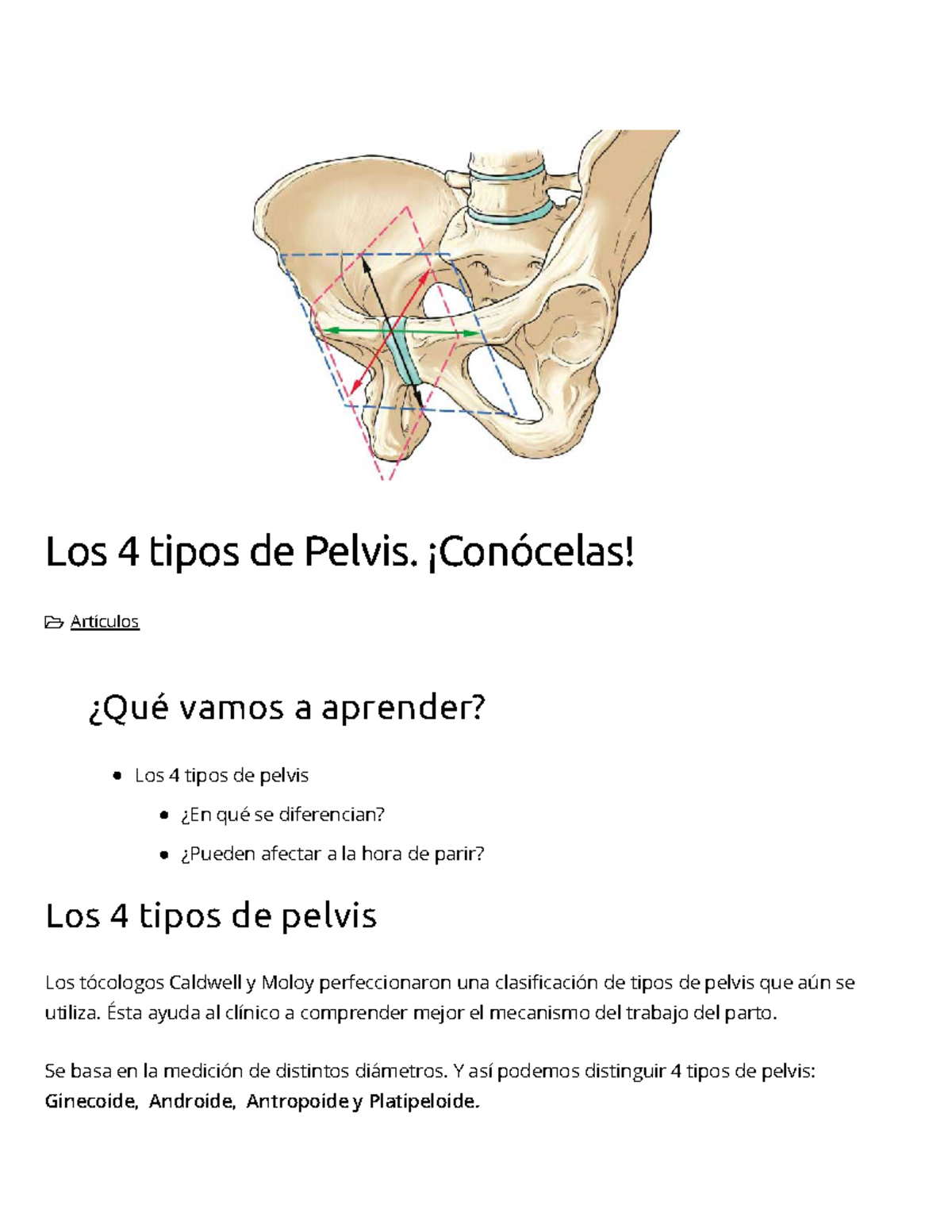 Los 4 Tipos de Pelvis: Clasificación y Relevancia en el Parto - EOM ...