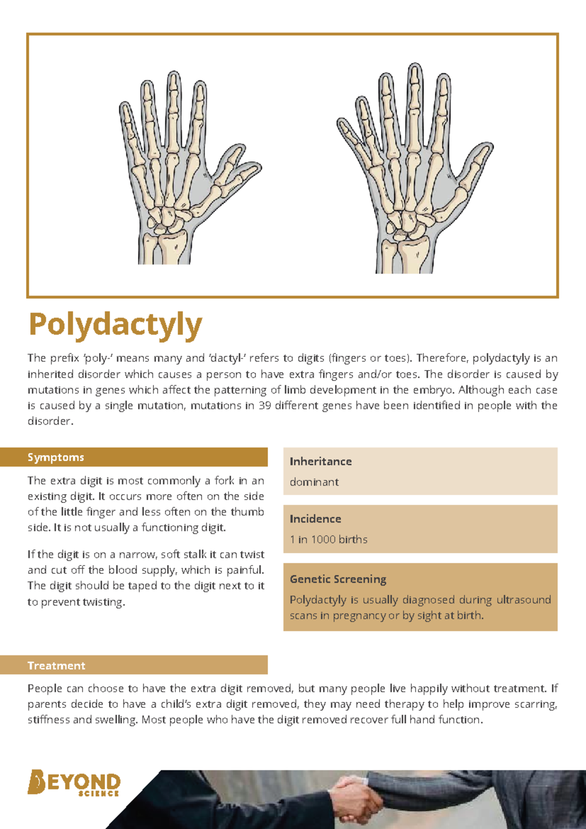 Polydactyly Overview: Causes, Symptoms, and Treatment - Studocu