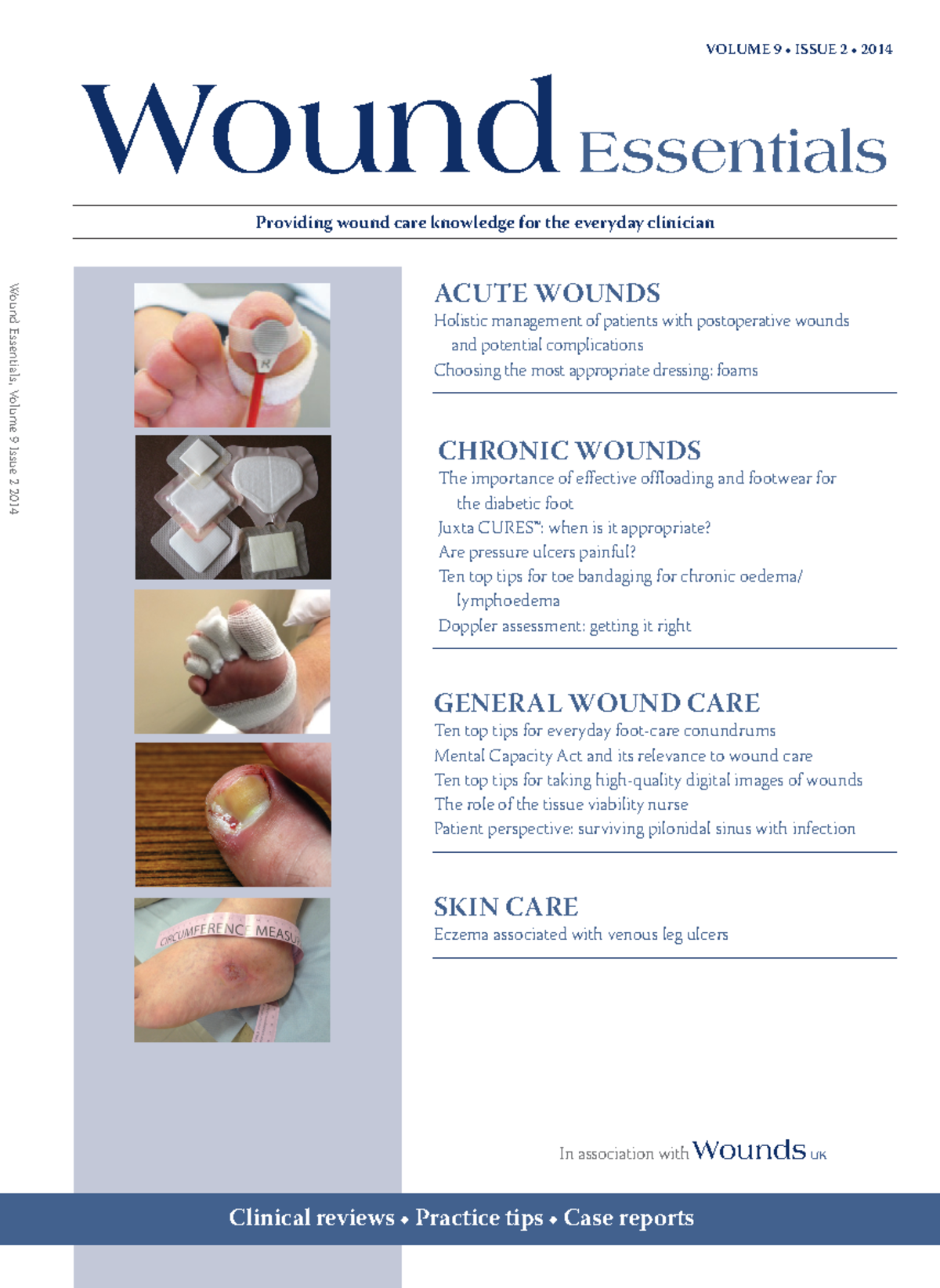 Wound essentials 9 2 - VOLUME 9 • ISSUE 2 • 2014 Clinical reviews ...
