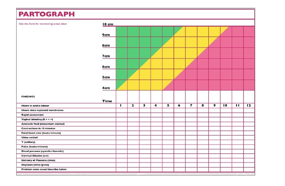 Simplified Partograph for Active Labor Monitoring Guide - Studocu