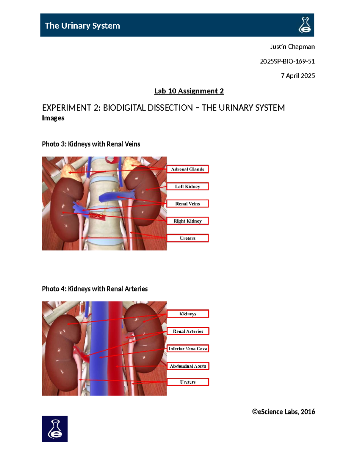 AP_5045_Lab10_Urinary_System_Biodigital_Dissection_Notes - Studocu