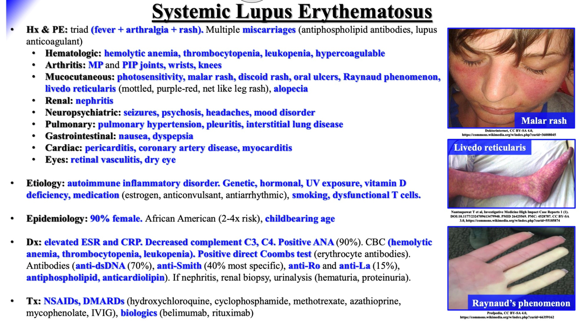 Screenshot 2025-01-11 at 9.39.31 PM - Systemic Lupus Erythematosus Hx ...