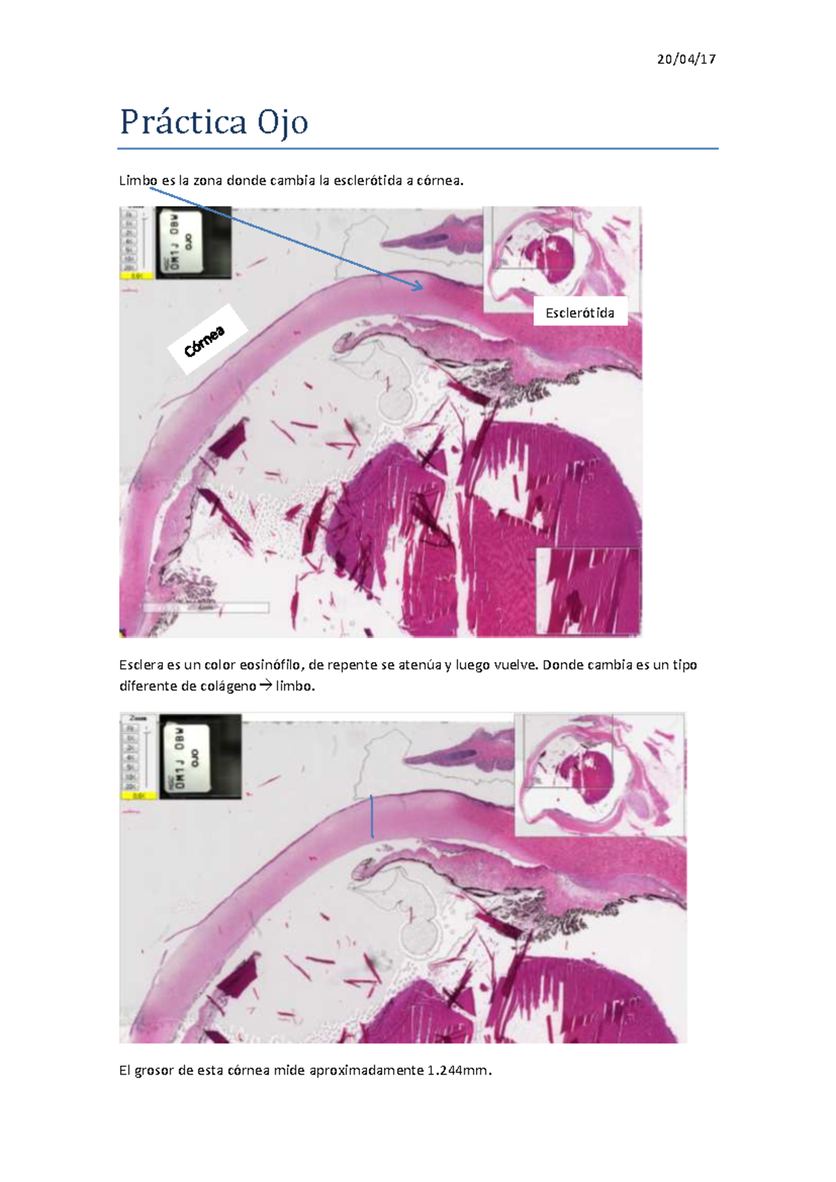Histología Práctica Ojo - Ojo Limbo es la zona donde cambia la a ...