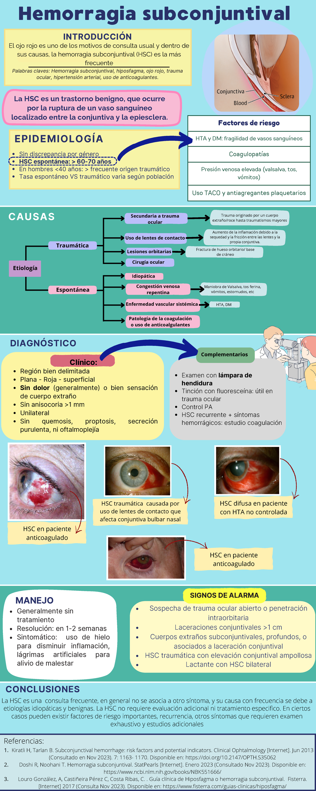 Hemorragia subconjuntival - oftalmología 2022 - Sospecha de trauma ...