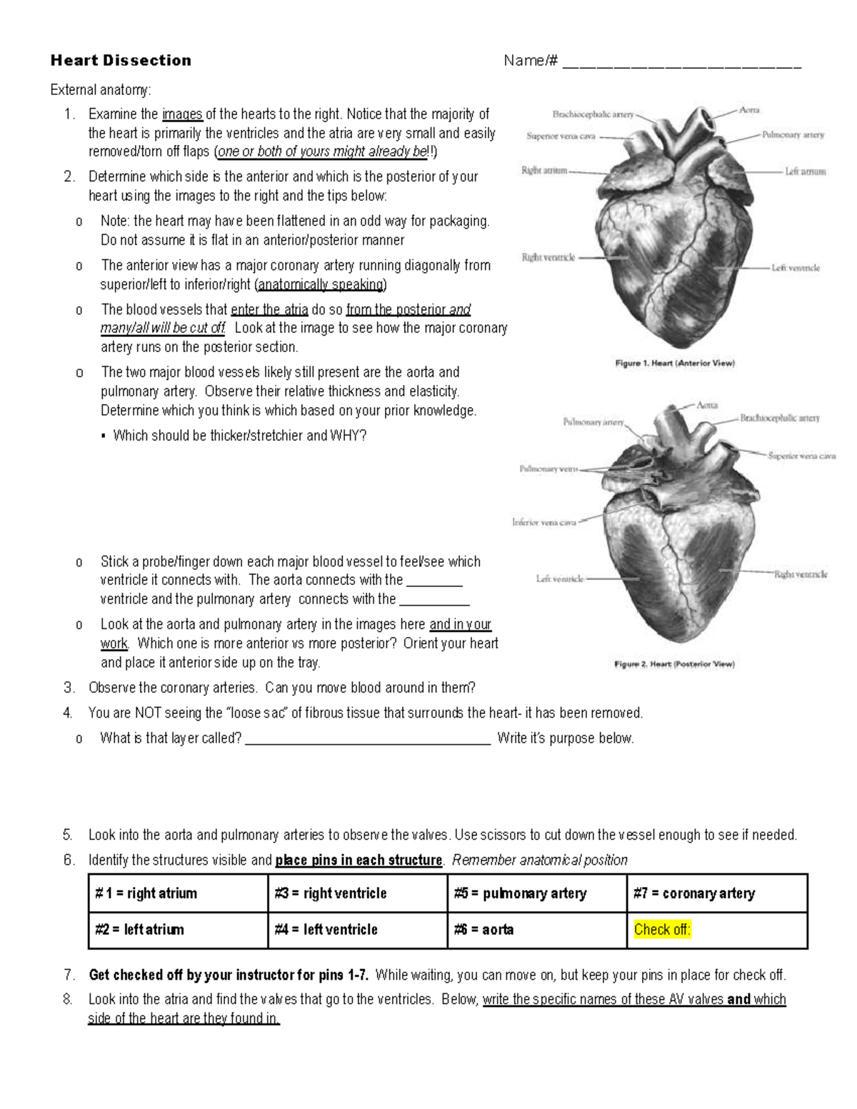 S25 Heart Dissection: External Anatomy and Blood Vessel Identification ...