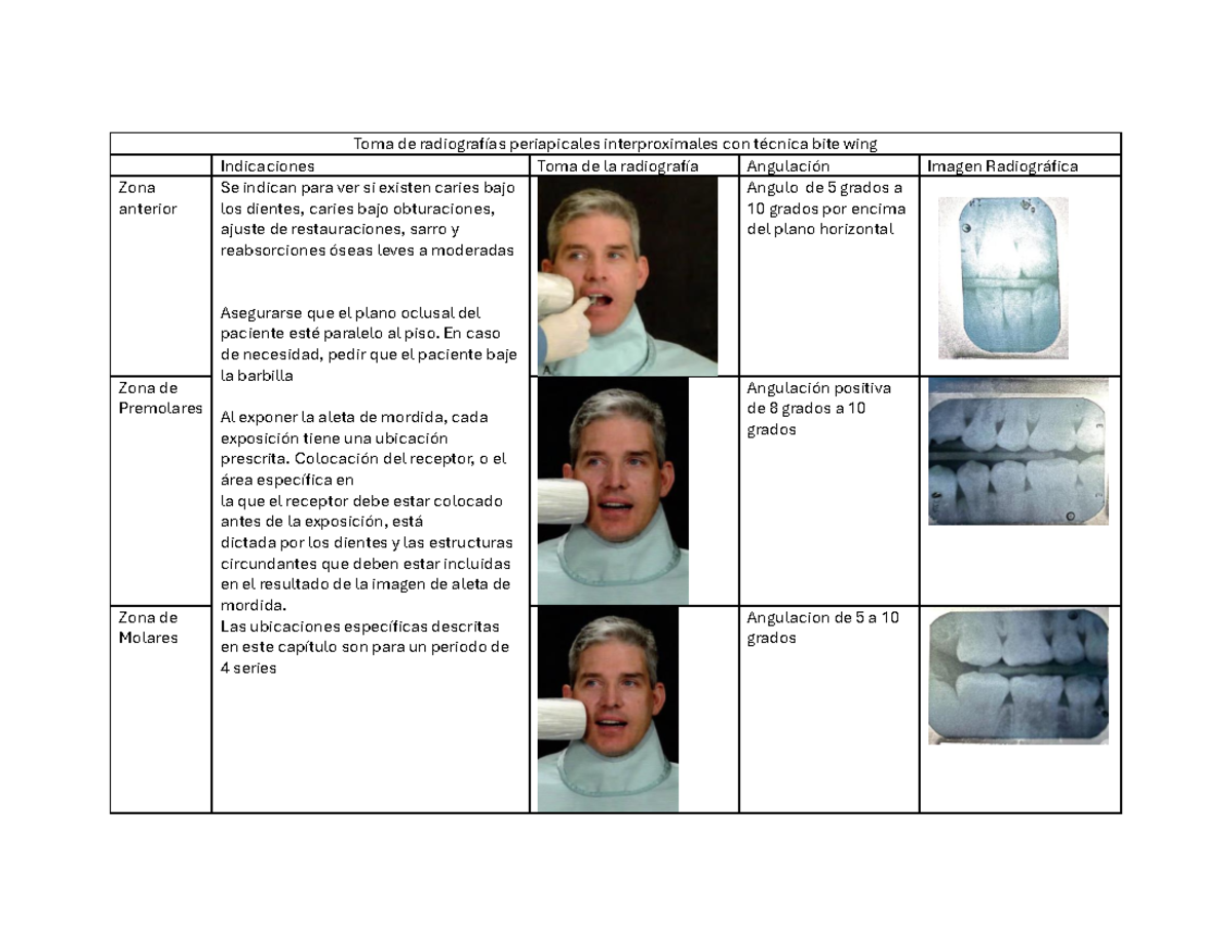 Técnica Bite Wing para Toma de Radiografías Periapicales - Studocu