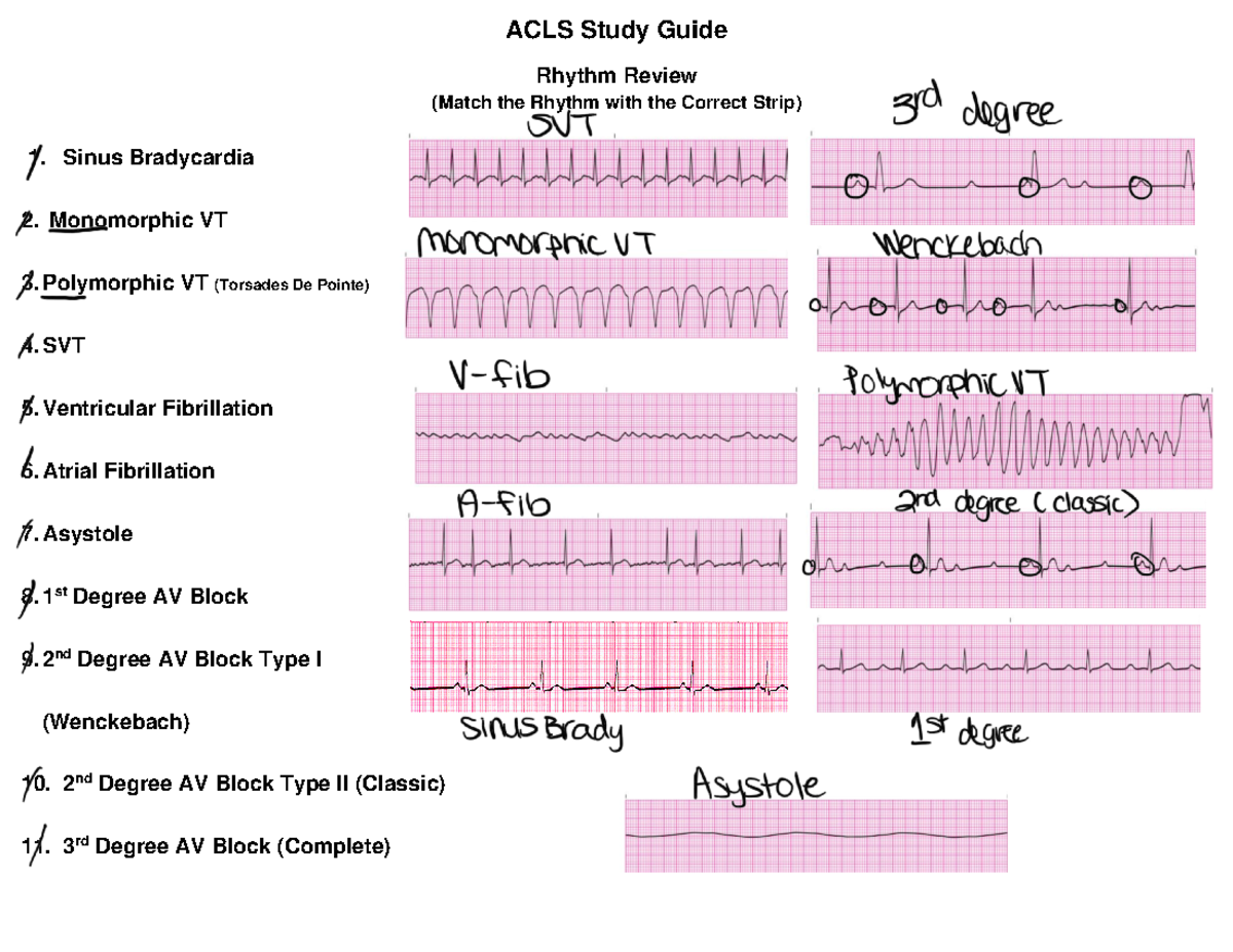 ACLS Study Guide: Rhythm Review & Assessment Techniques - Studocu