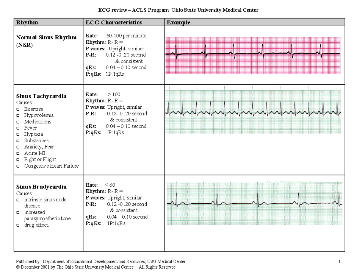 Exam 3: EKG Examples and ECG Characteristics for ACLS Program - Studocu