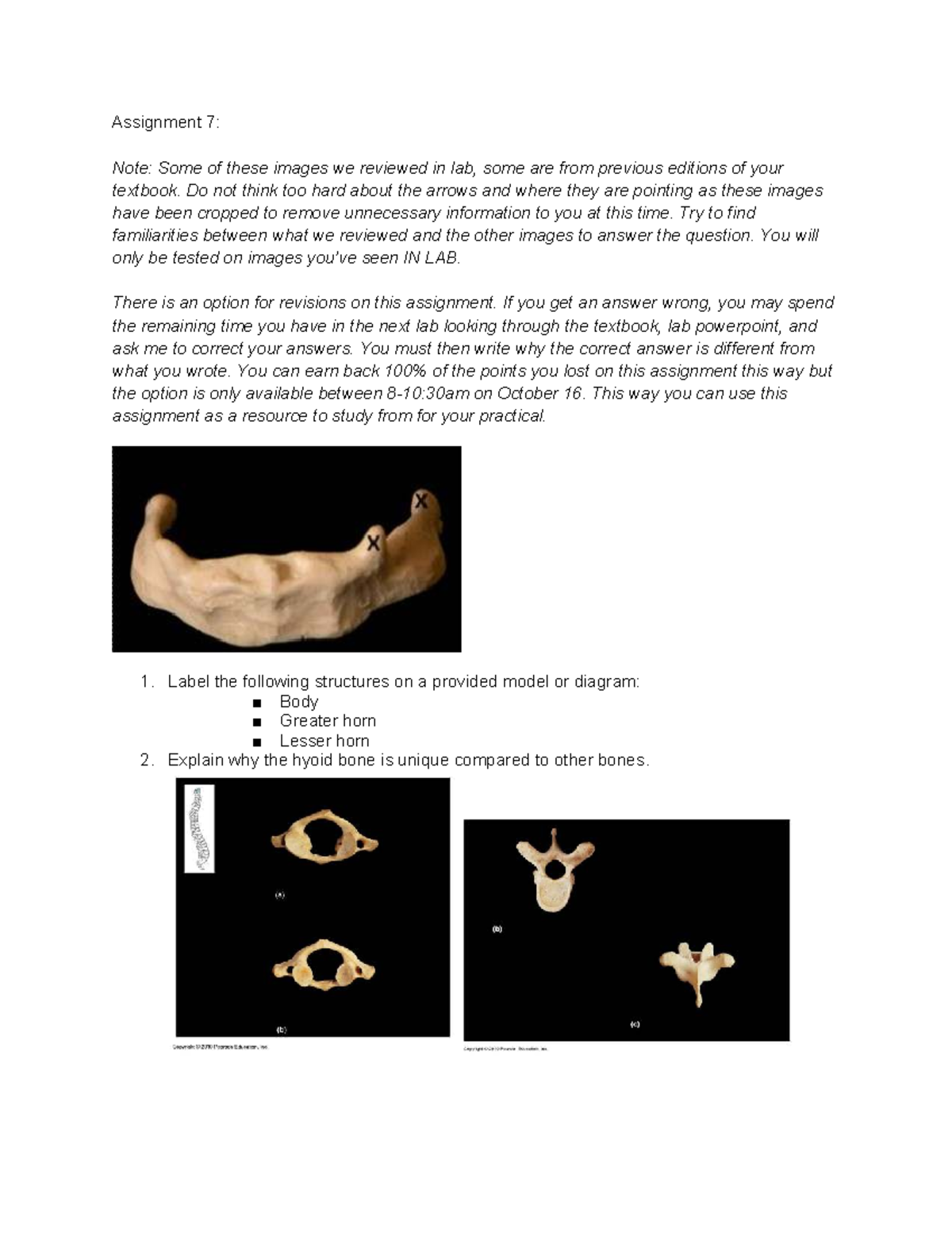Anatomy Assignment 7: Labeling Bones & Vertebrae Structures - Studocu