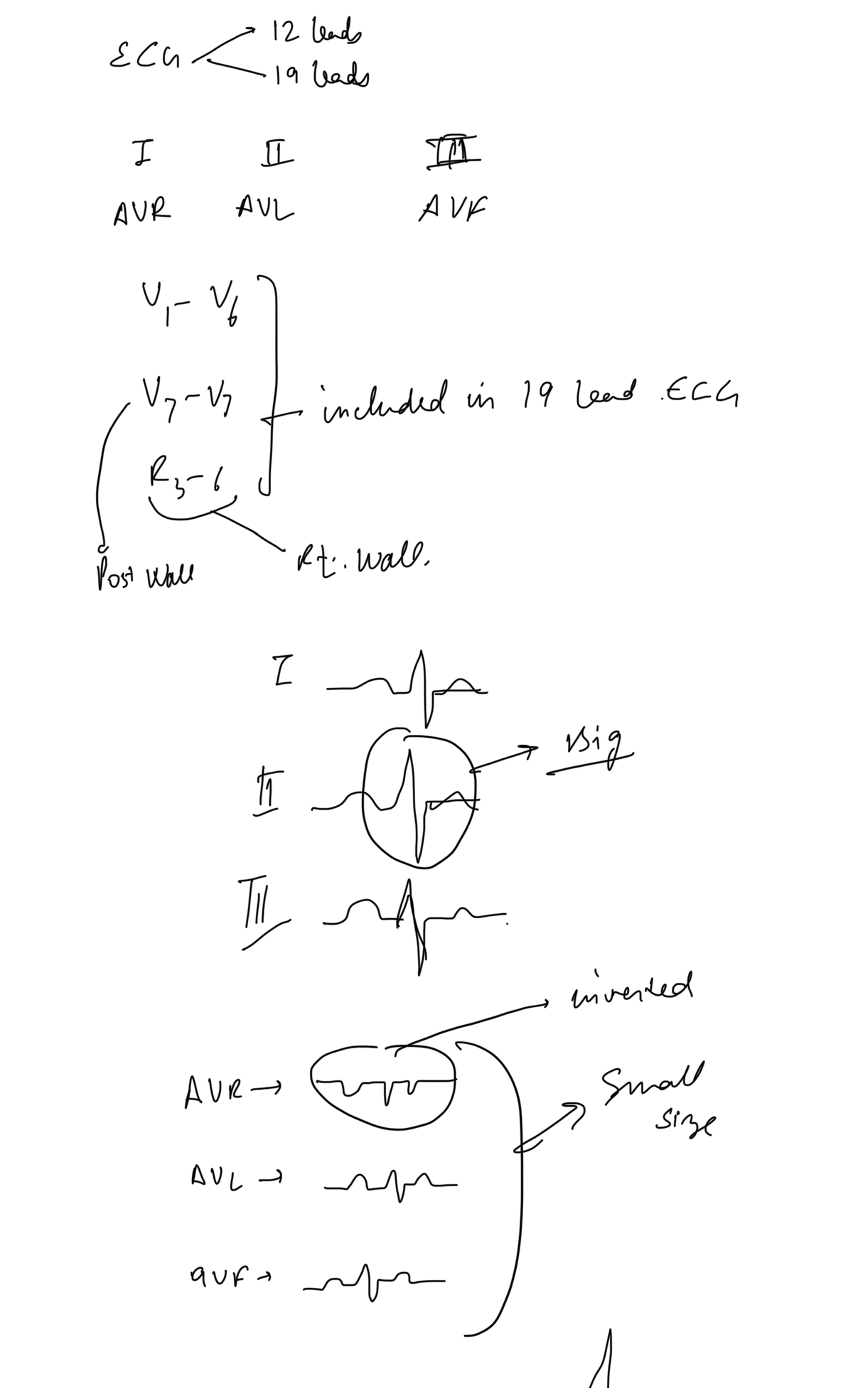 Ecg - Ecg - Mathematics: Analysis and Approaches SL - 12 leads ECG 19 ...