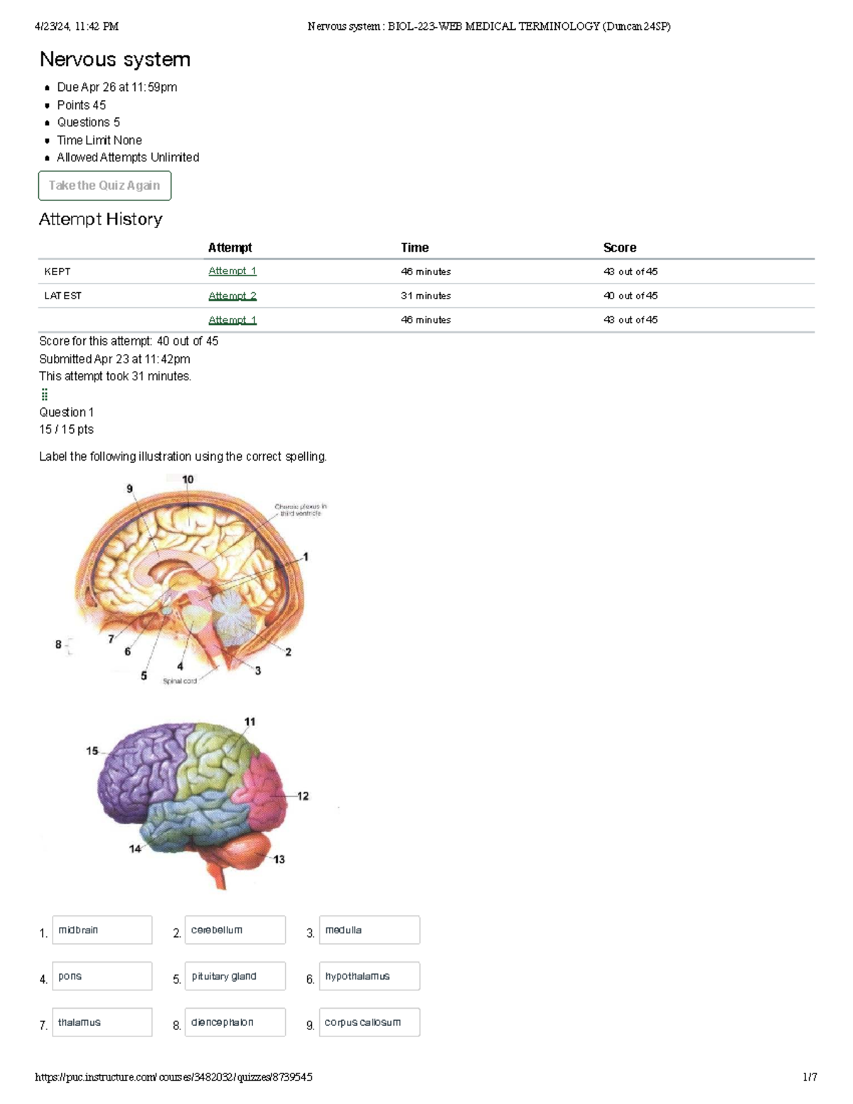 Nervous System Terminology Quiz Review: MEDICAL TERMINOLOGY (Duncan ...