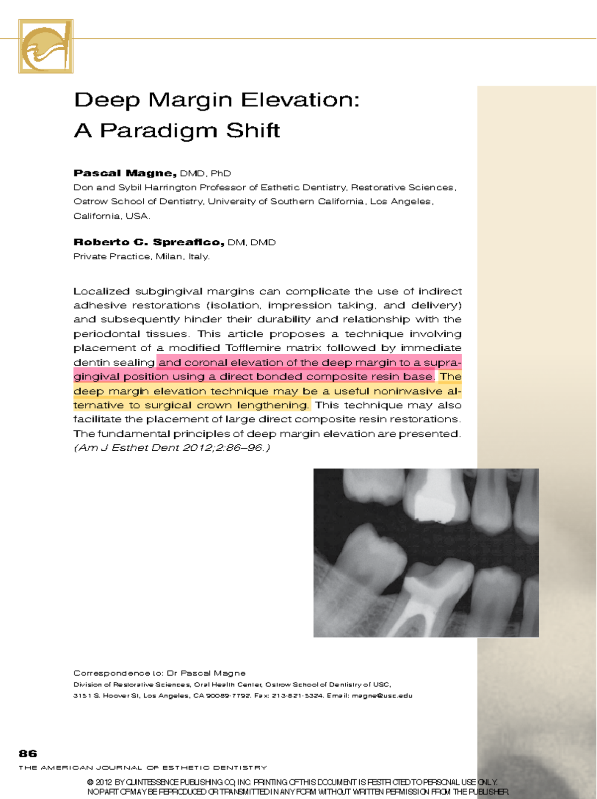 Deep Margin Elevation: A Noninvasive Technique for Restorative ...