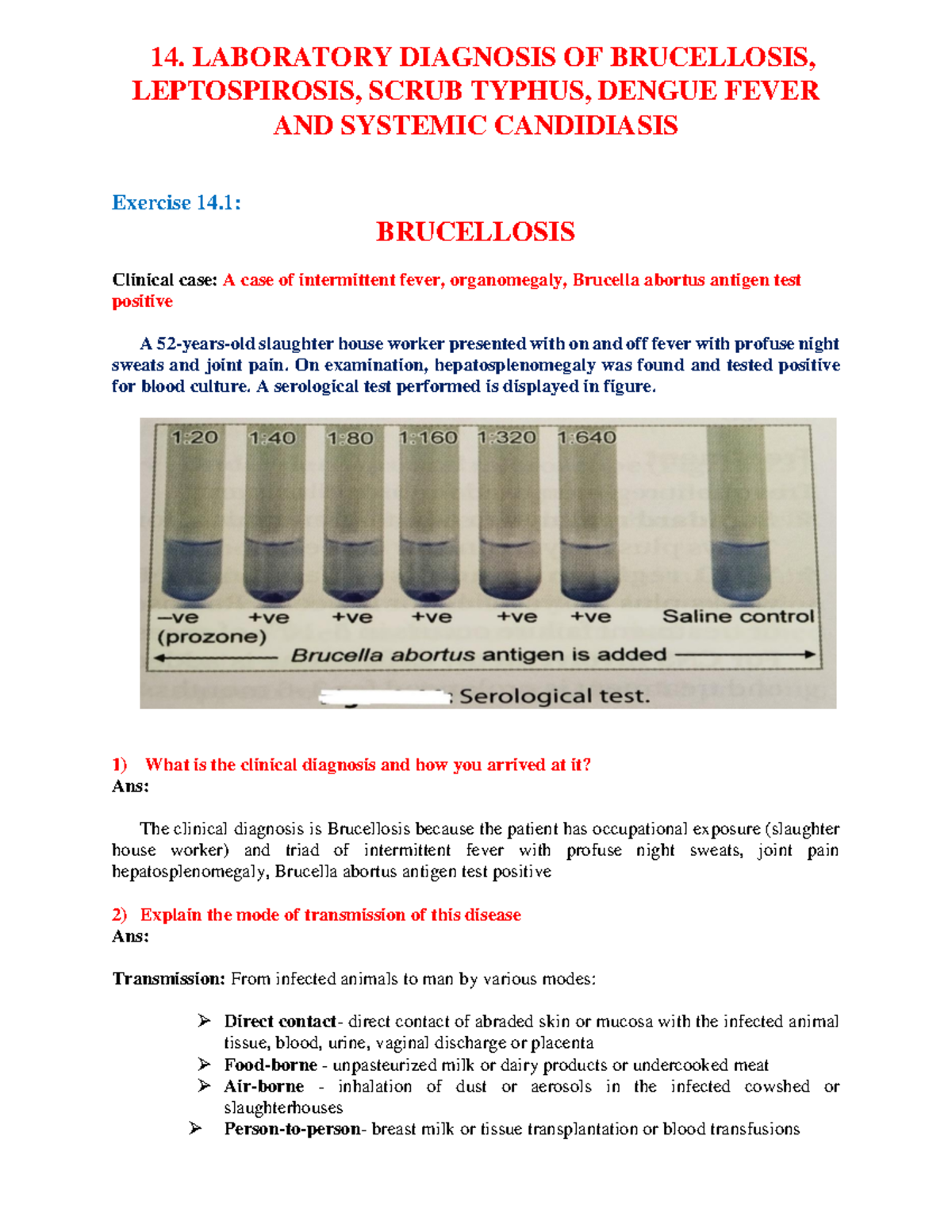 14. LAB DIAGNOSIS OF BRUCELLOSIS, LEPTOSPIROSIS & DENGUE FEVER - Studocu