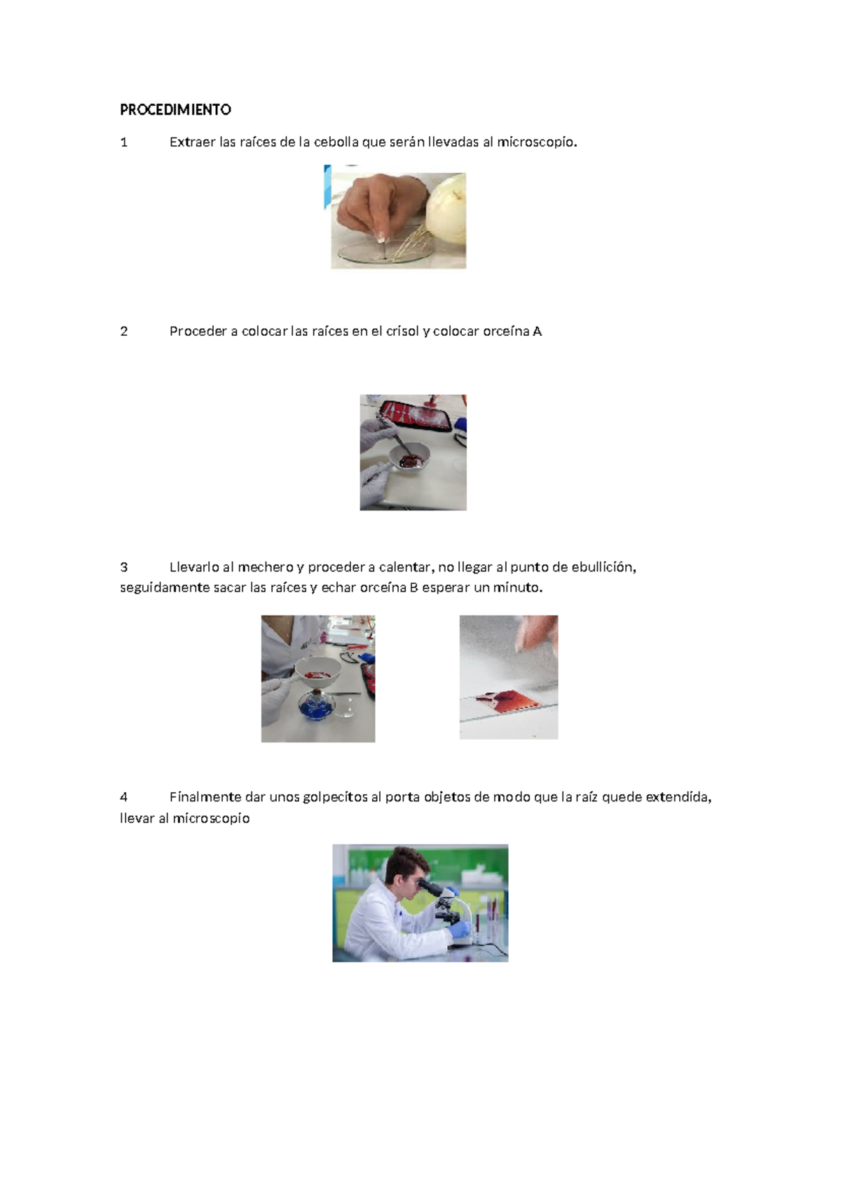 Sesión 8 - Procedimiento para Microscopía de Raíces de Cebolla - Studocu
