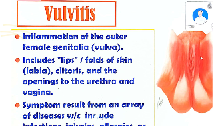 CS Maternal Health: Understanding Vulvitis and Vaginitis - Studocu