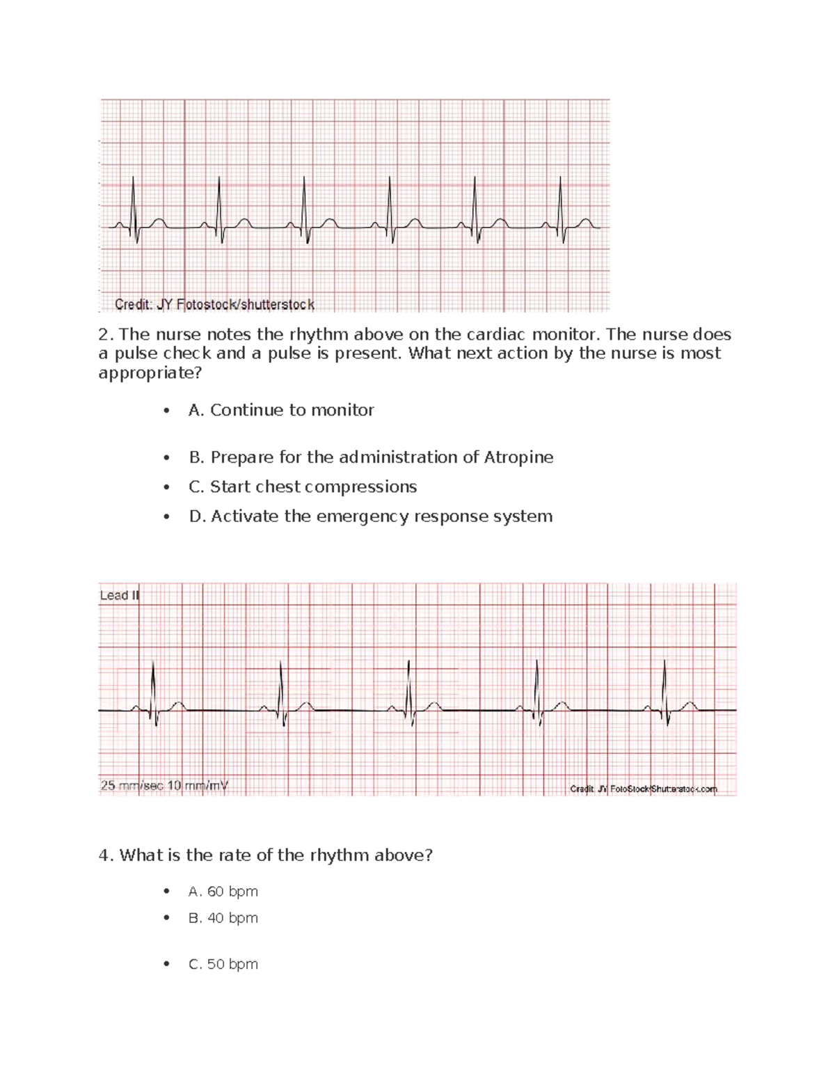 EKG Practice Quiz - Cardiac Rhythm Analysis (N.A.) - Studocu