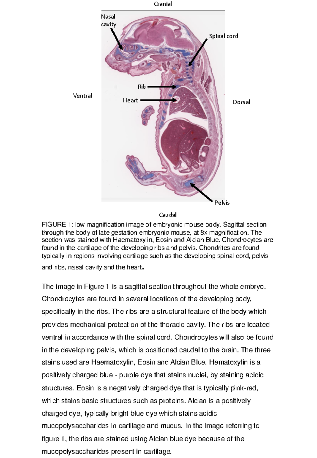 Lab report 1 dev example - Cranial Caudal Dorsal Ventral Spinal cord ...