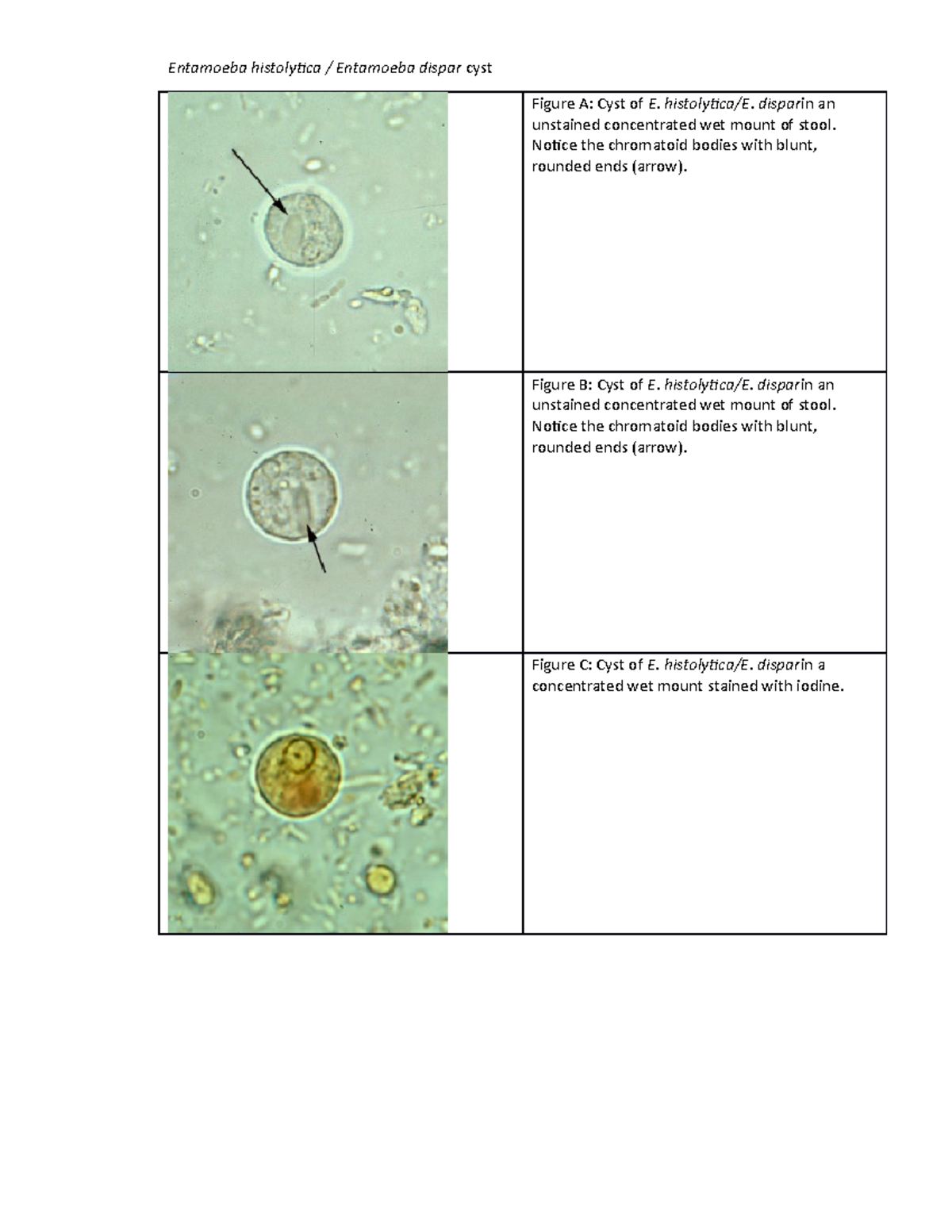 E. histolytica/E. dispar Cysts and Trophozoites: Staining Techniques ...