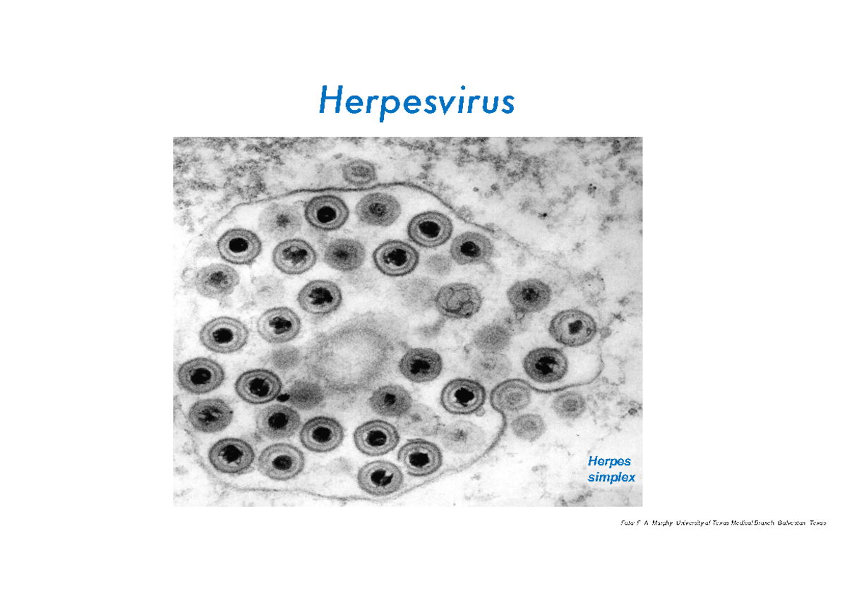 Herpesvirus- Apotek-HT24 - Herpes simplex Foto: F. A. Murphy ...