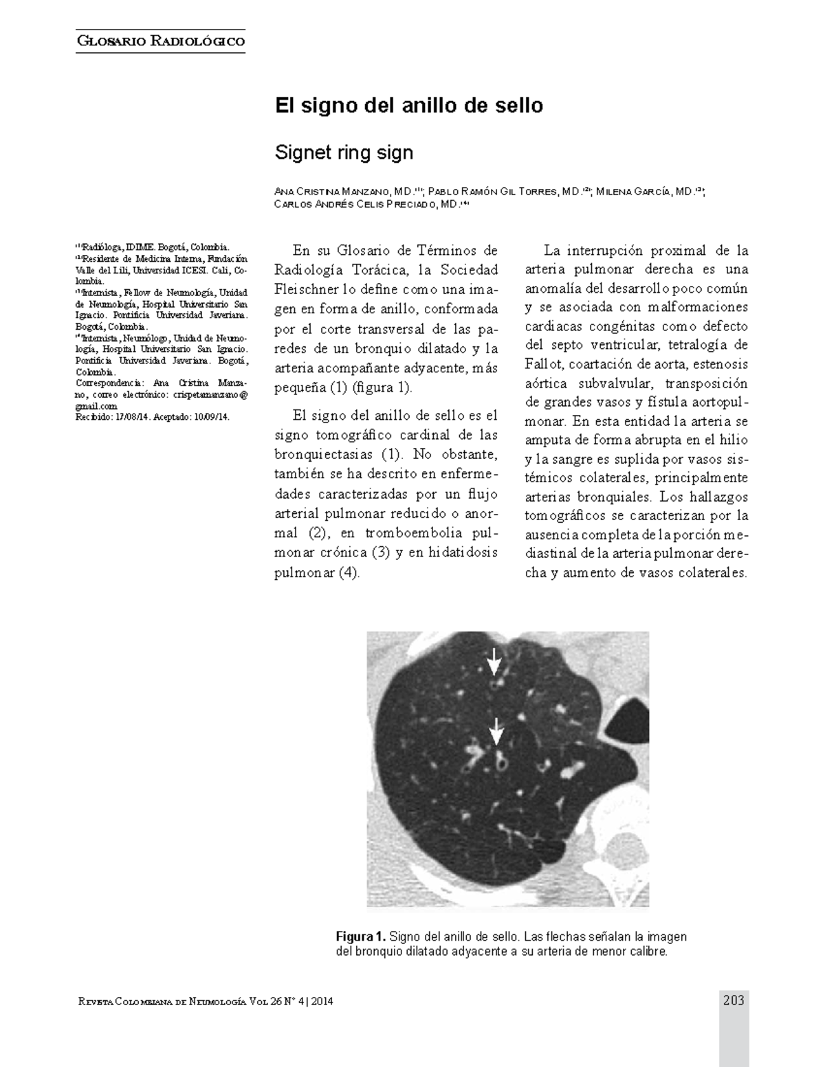 Glosario Radiológico: Signo del Anillo de Sello en Neumología - Studocu