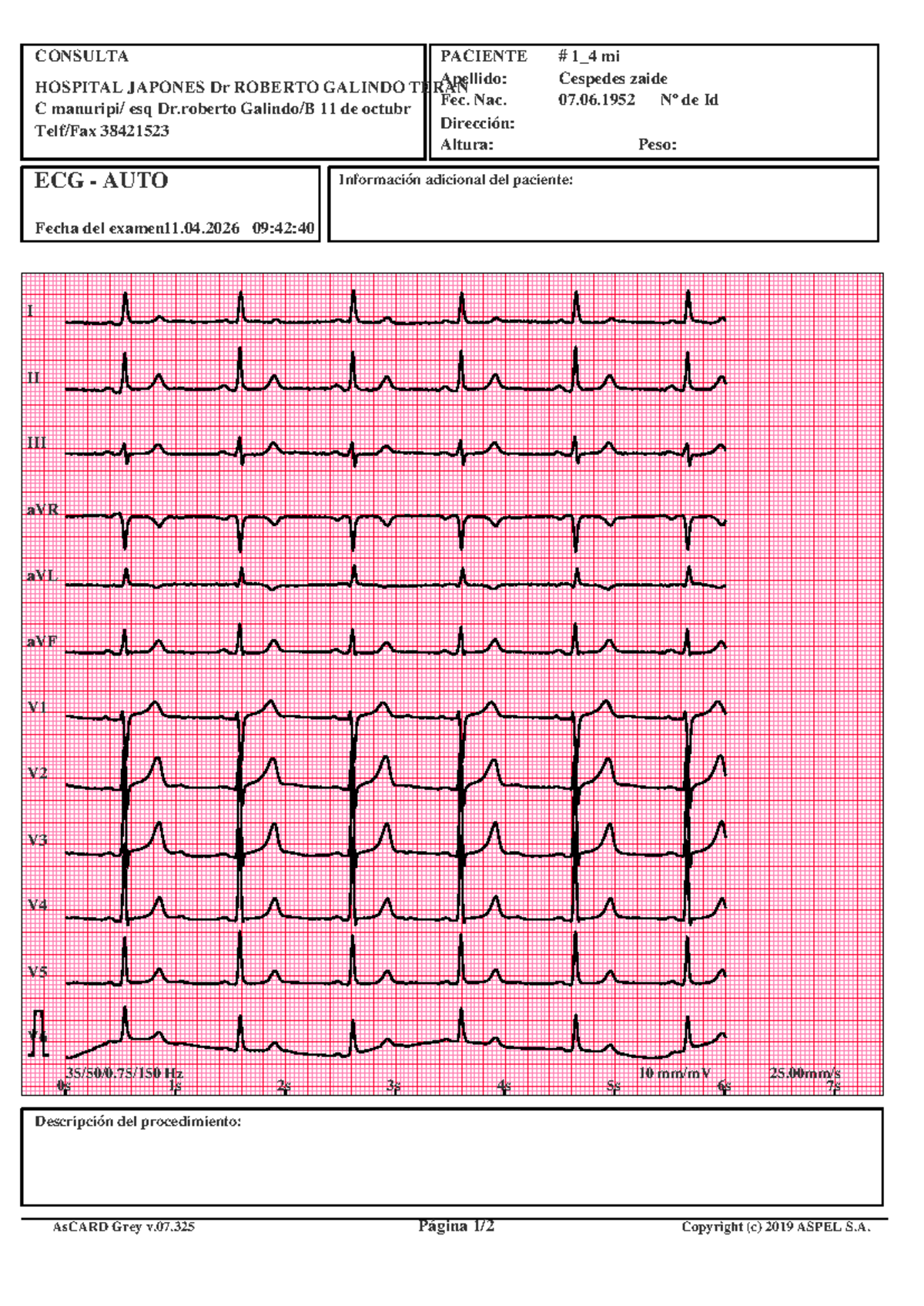 ECG Report for Patient Cespedes Zaide - Hospital Japonés - Studocu