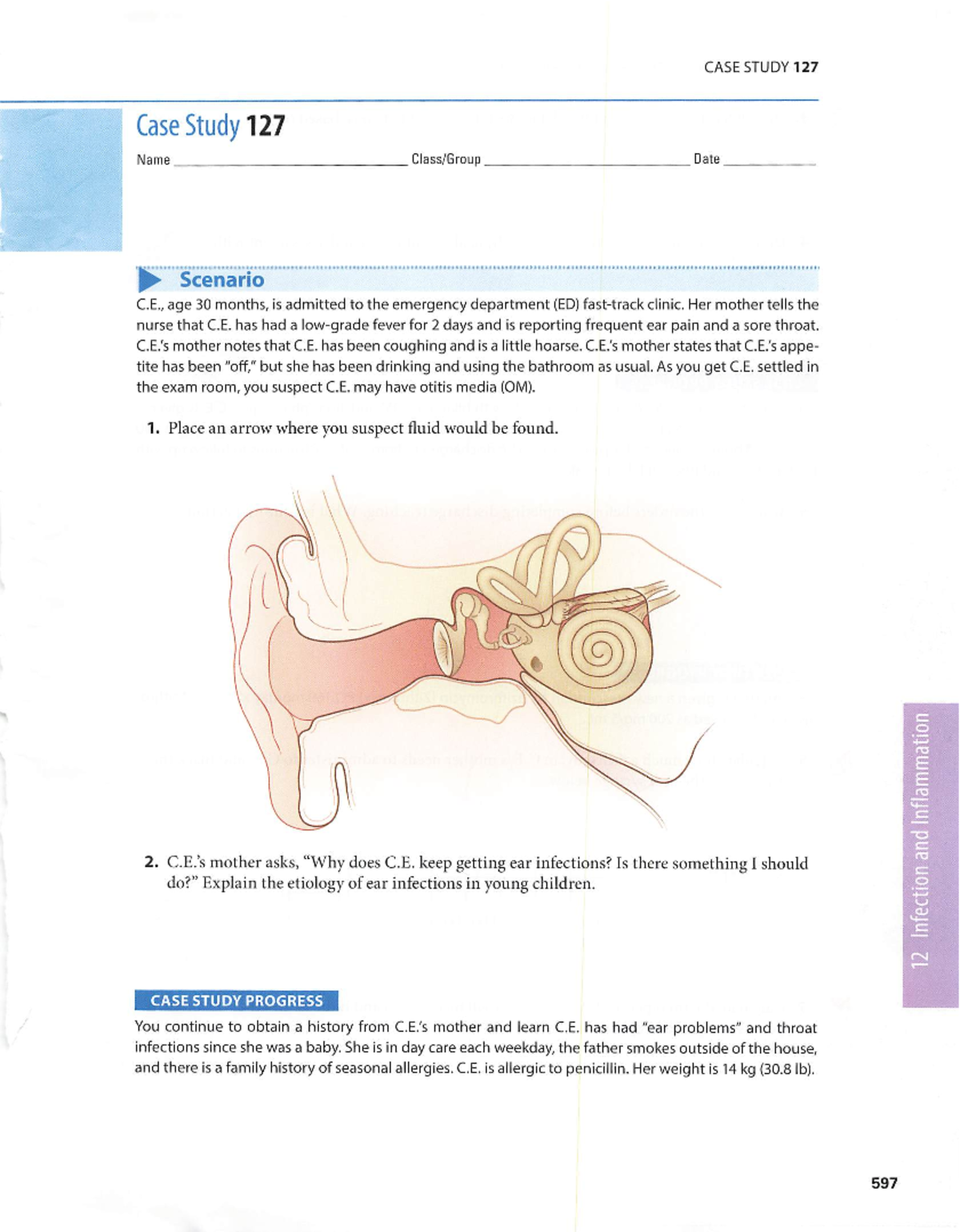 Peds Case Study #127: Otitis Media & Strep Pharyngitis in 30-Month-Old ...