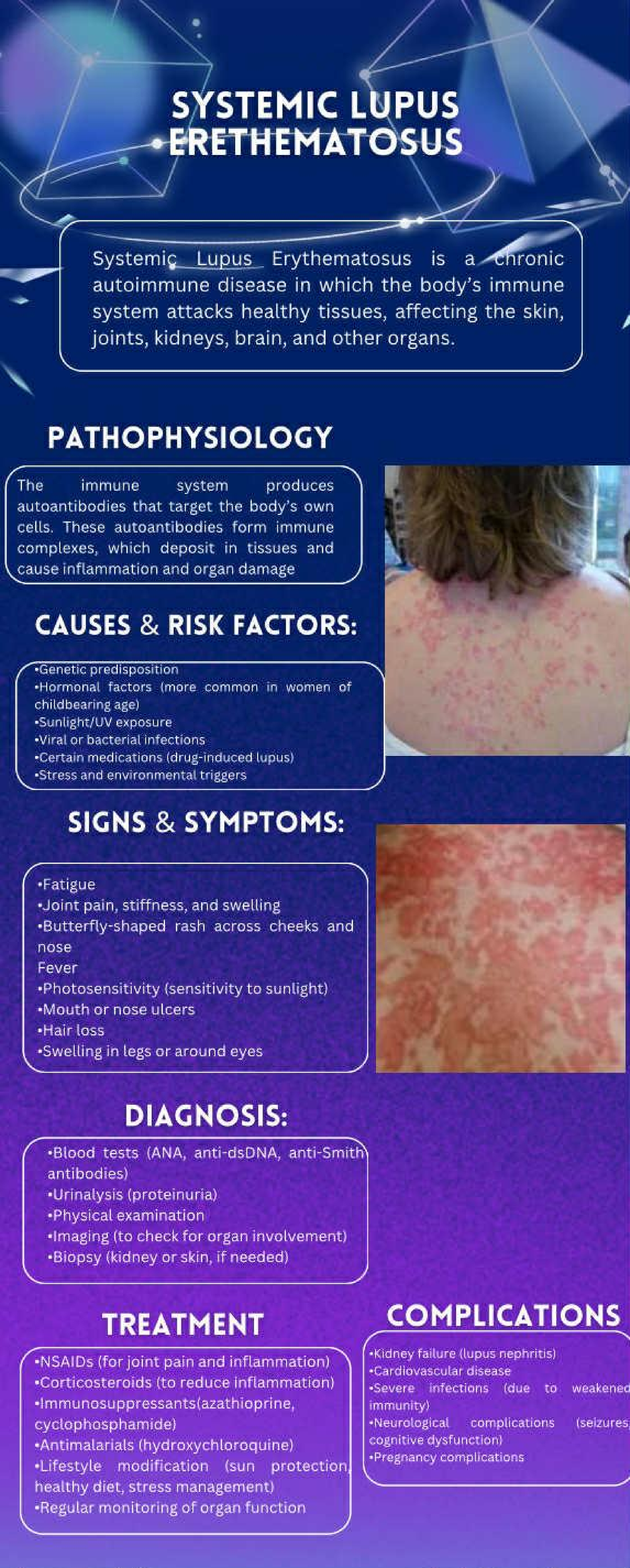 Autoimmune Diseases Overview: SLE, RA, MS, and More - Studocu