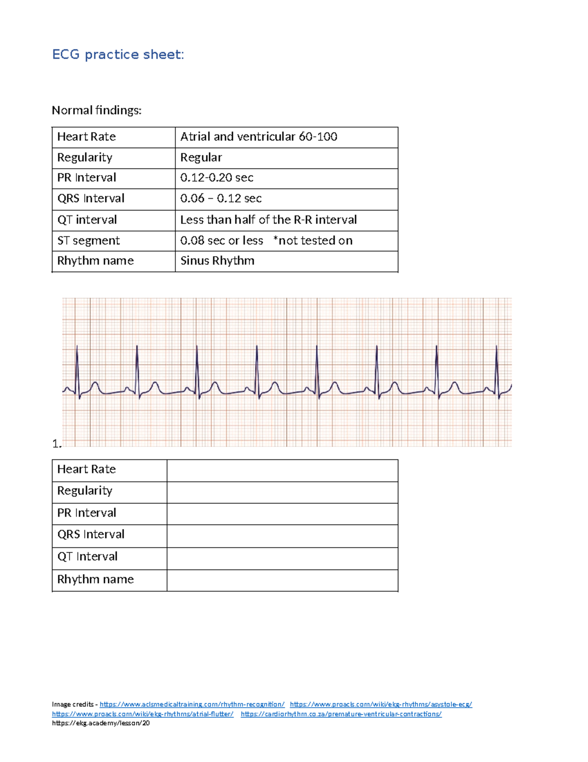 ECG Practice Sheet 3313: Normal Findings & Rhythm Analysis 2022 - Studocu