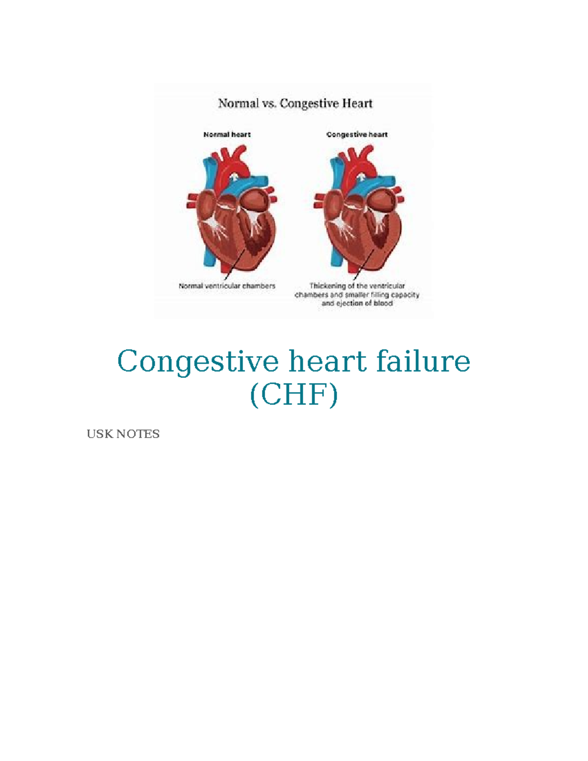 Congestive heart failure - ## Types of Heart Failure ### Systolic Heart ...