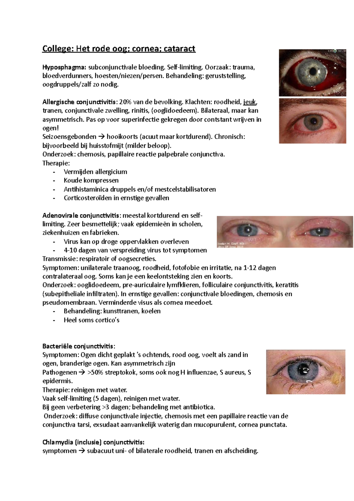 Het rode oog en cataract: College Overzicht en Behandeling - Studeersnel