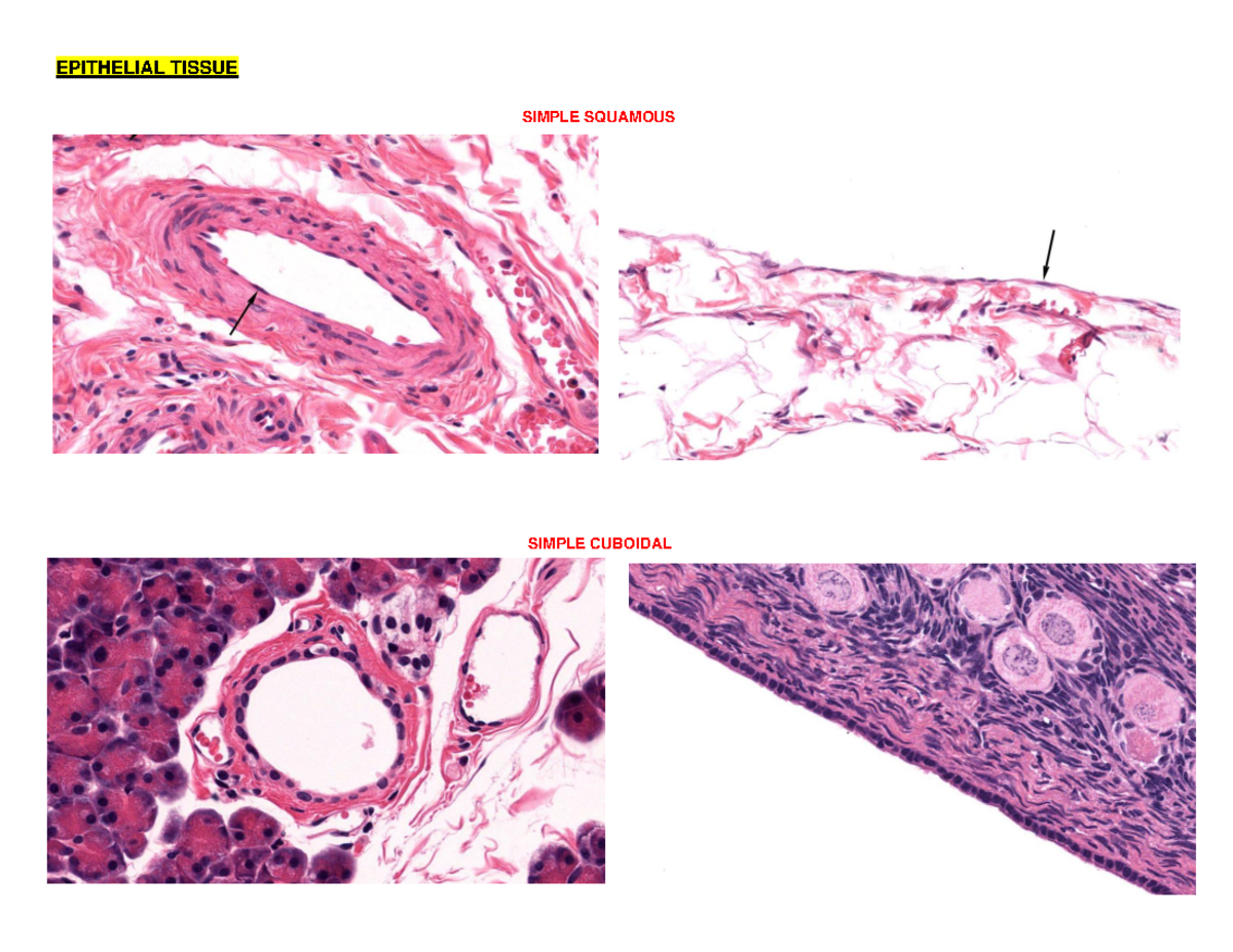 Epithelial- Muscle Tissue- Semis - EPITHELIAL TISSUE SIMPLE SQUAMOUS ...