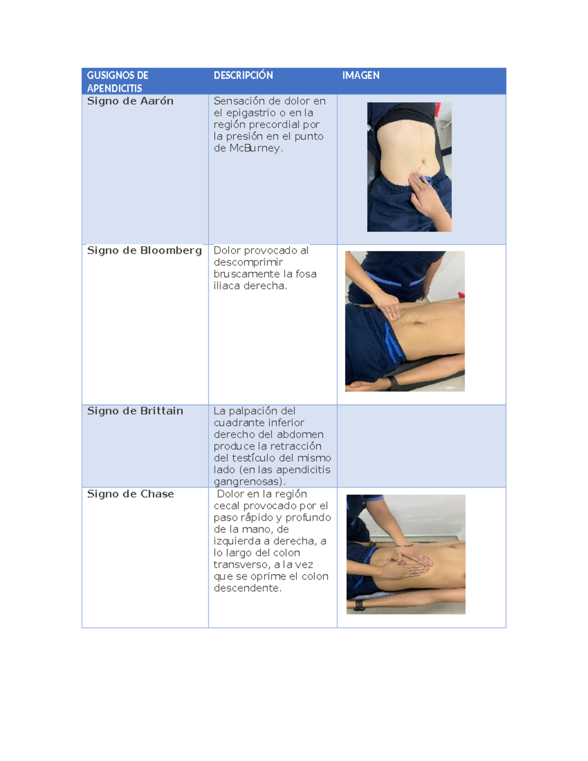 Signos de apendicitis - ...... - GUSIGNOS DE APENDICITIS DESCRIPCIÓN ...